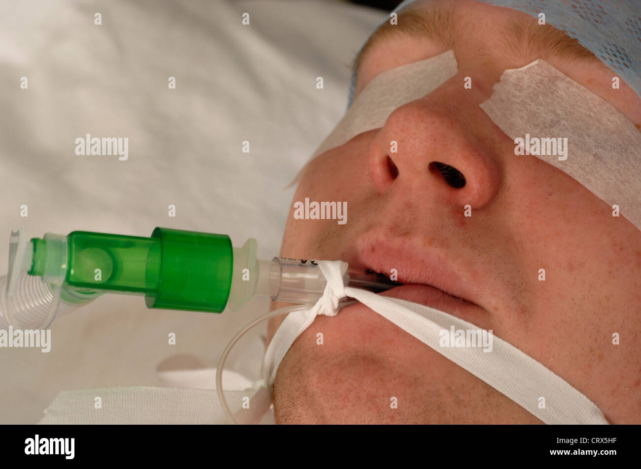 Close up of an anesthetized patient Stock Photo - Alamy