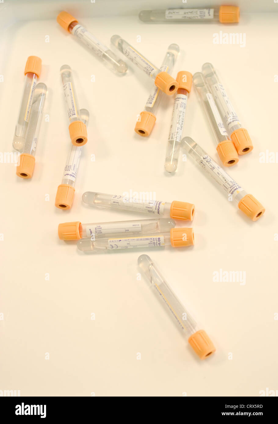 The kidney hi-res stock photography and images - Alamy