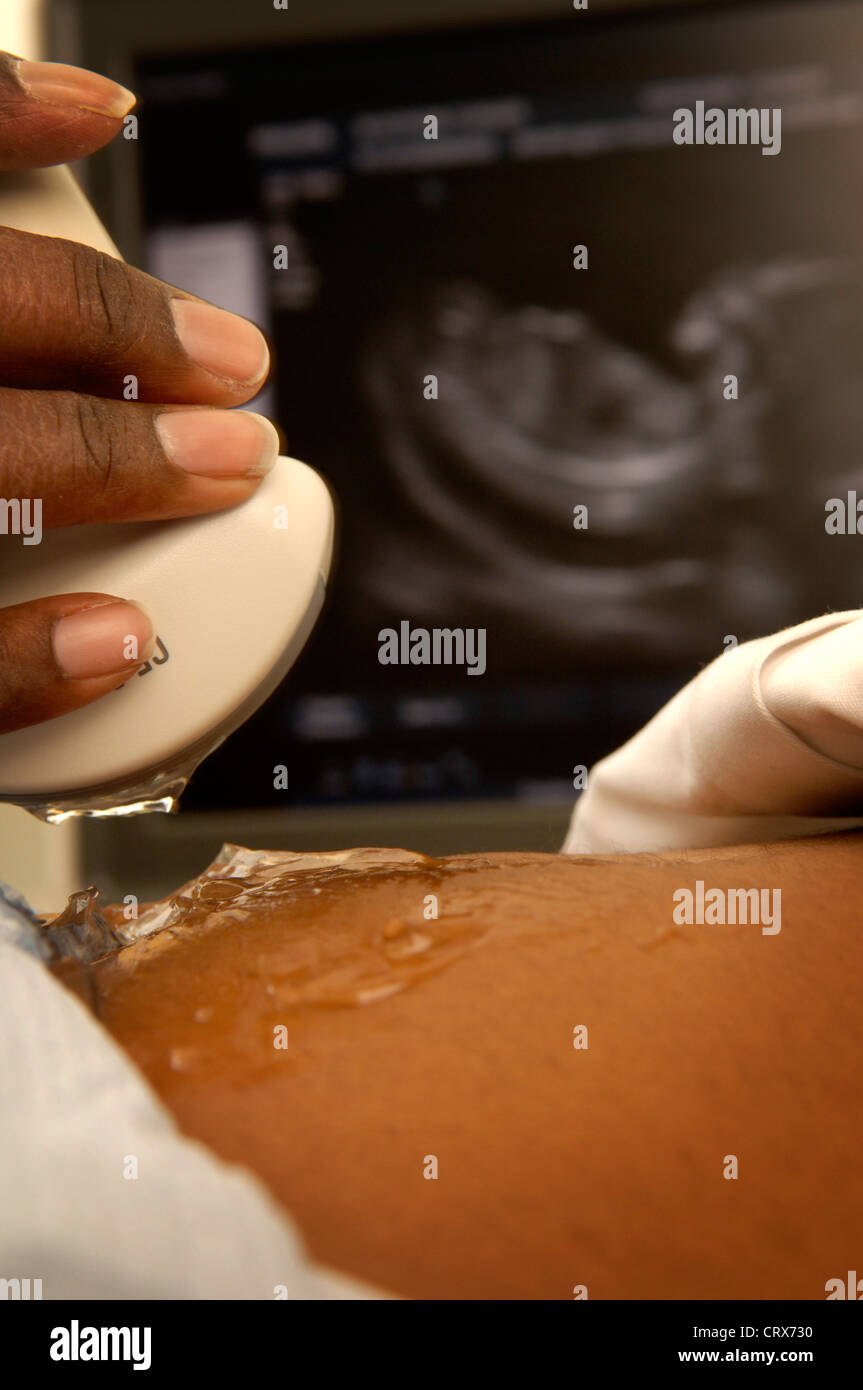 Antenatal Scan High Resolution Stock Photography and Images - Alamy
