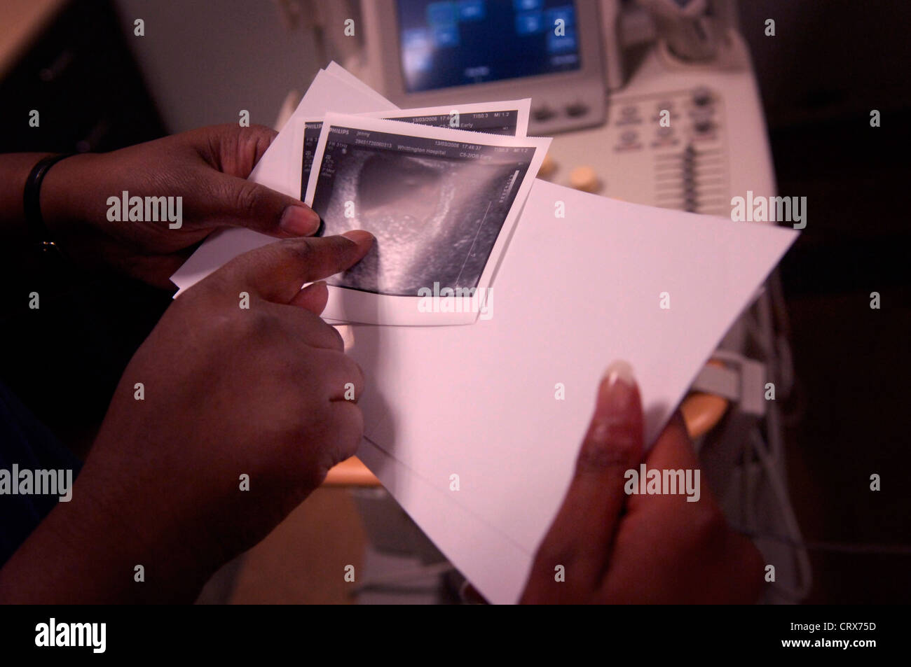 Antenatal hi-res stock photography and images - Alamy