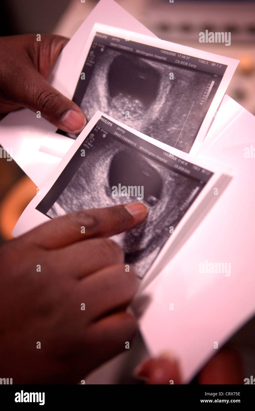 Sonogram Foetus High Resolution Stock Photography and Images - Alamy