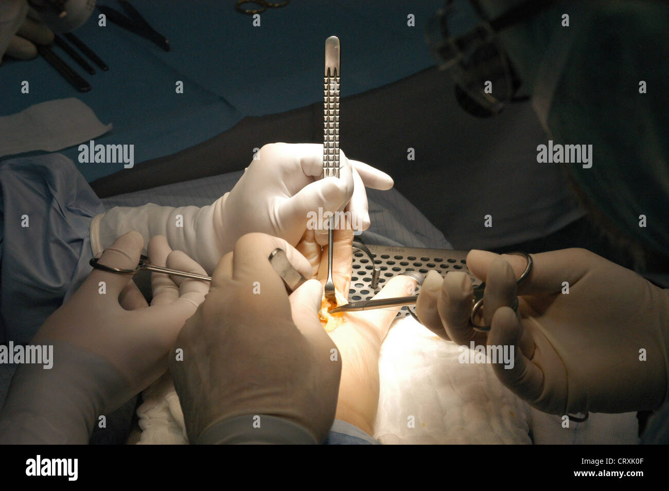 Surgeons in the operating room at a hand surgery Stock Photo - Alamy