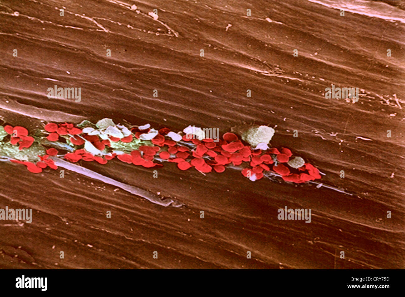 Platelet microscope hi-res stock photography and images - Alamy