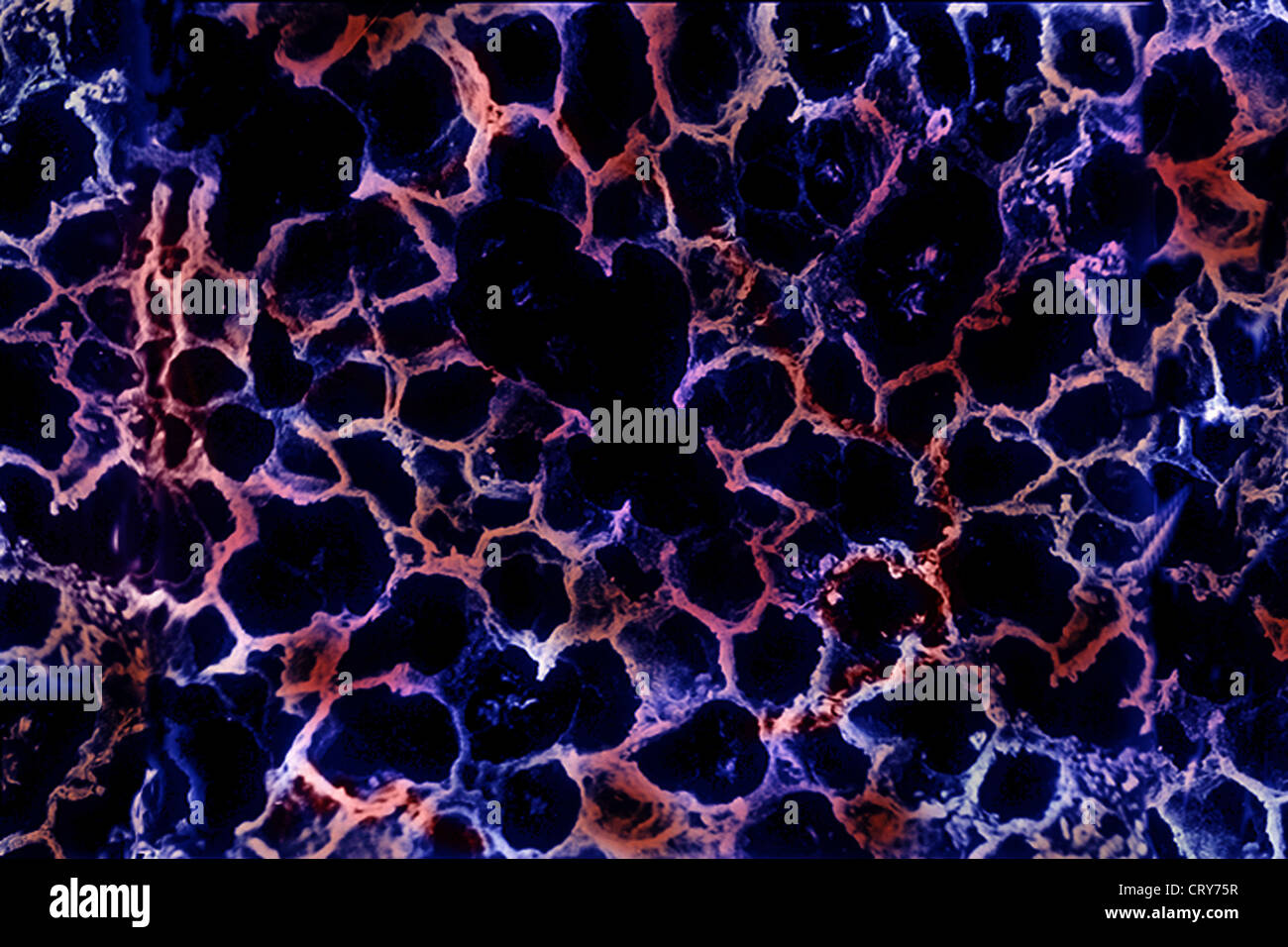 Lung alveolus micrograph hi-res stock photography and images - Alamy