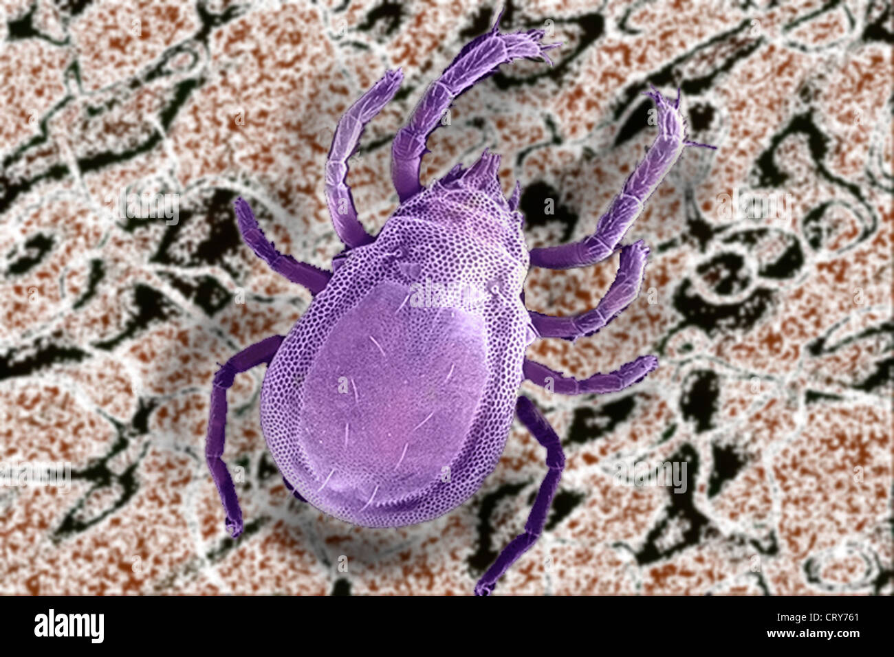 Dust mite microscope hi-res stock photography and images - Alamy