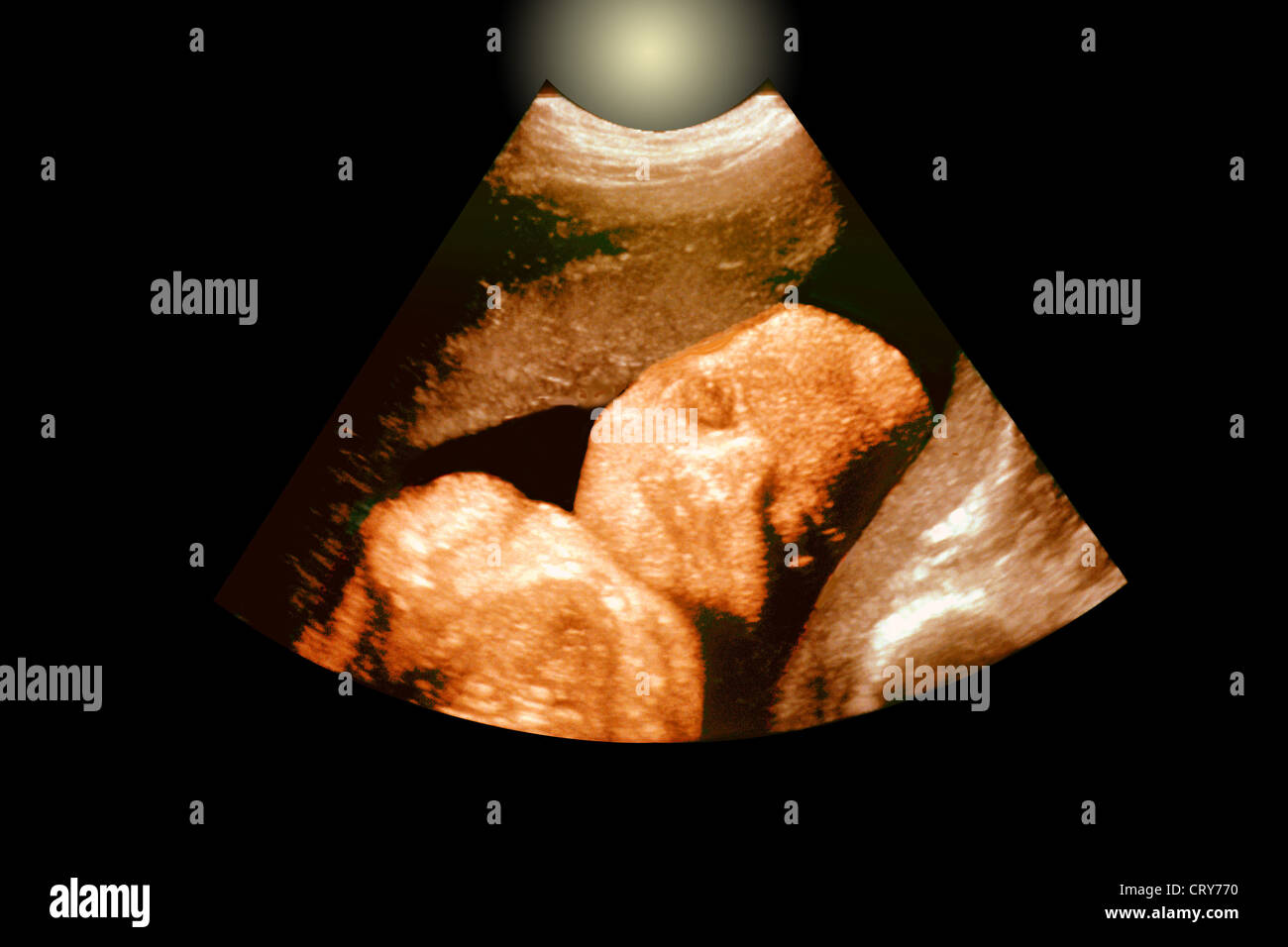 Fetus 7 months hi-res stock photography and images - Alamy