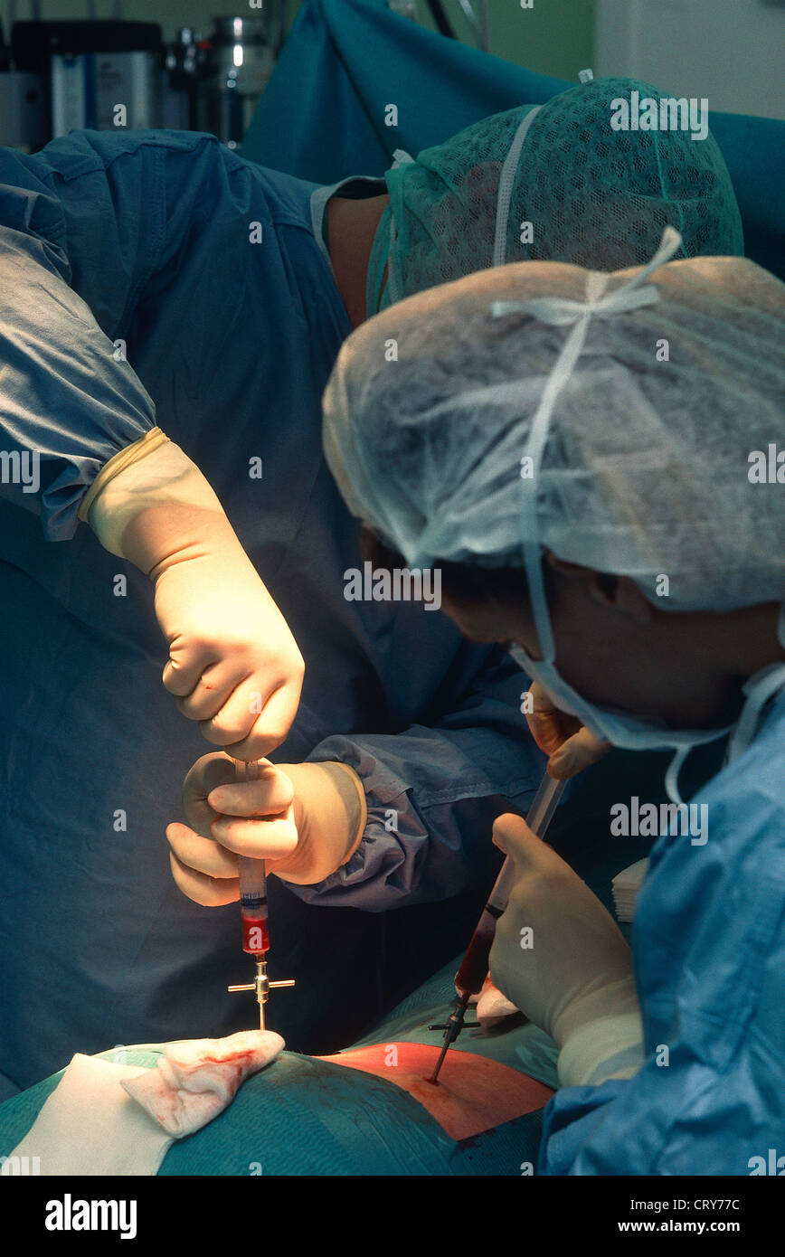 Bone marrow aspiration hi-res stock photography and images - Alamy