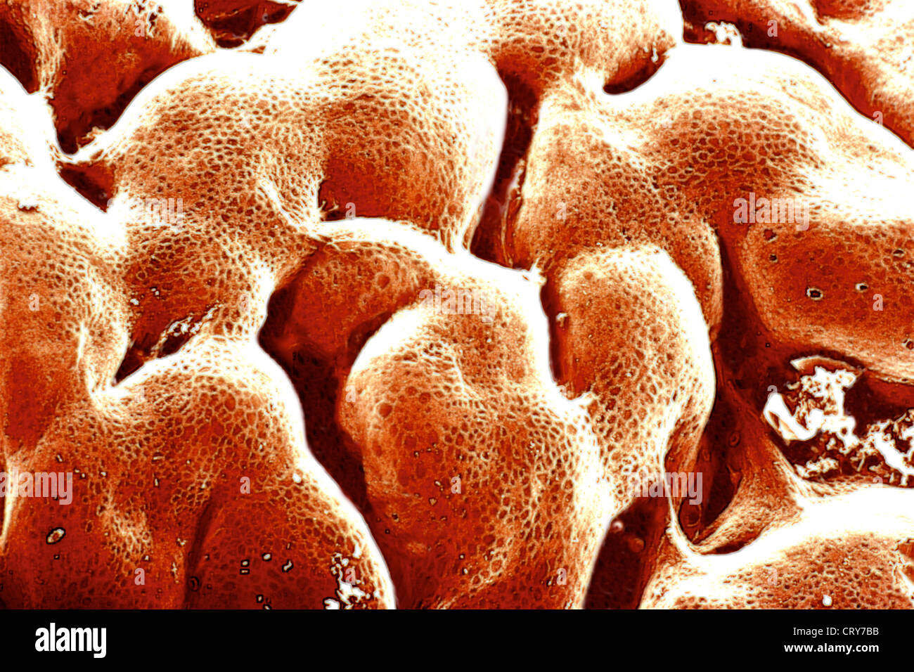 Gastric Mucosa Stock Photos & Gastric Mucosa Stock Images - Alamy Gastric Mucosa Stock Photos & Gastric Mucosa Stock Images - Alamy
