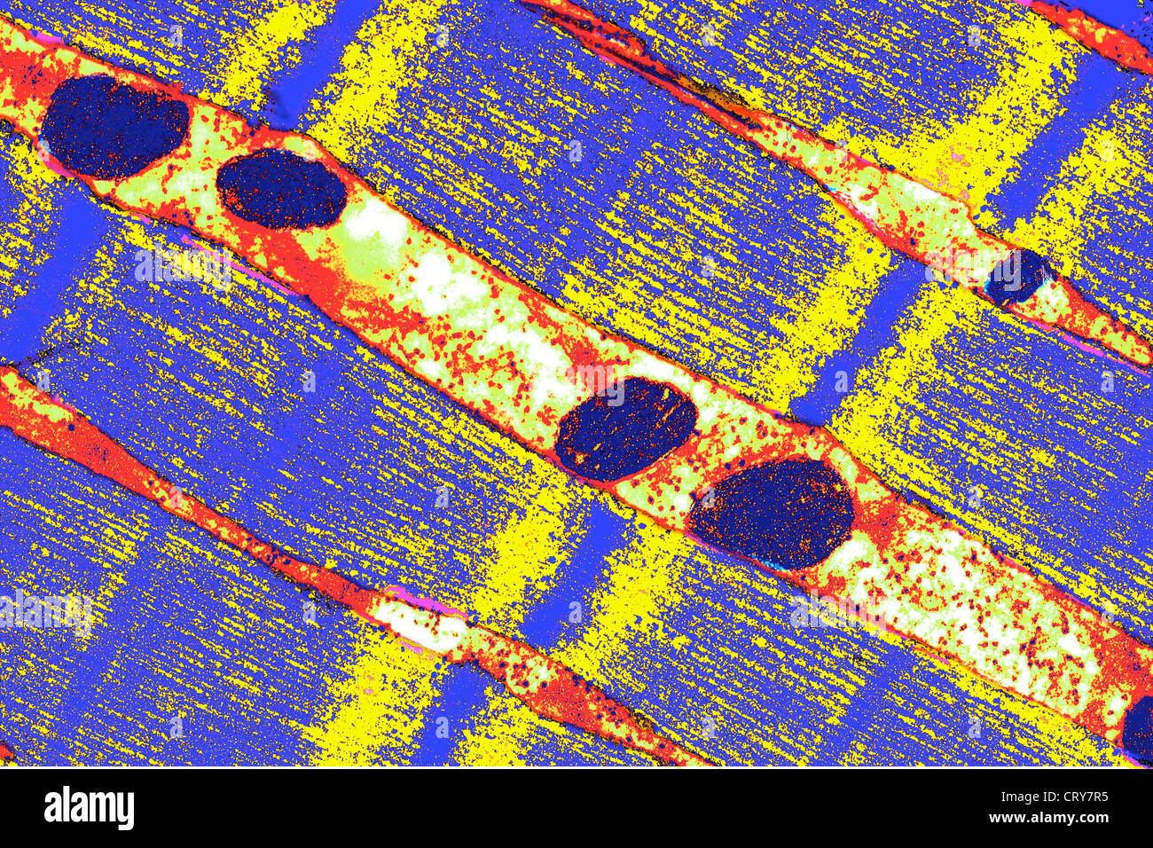 Striated muscle tem hi-res stock photography and images - Alamy