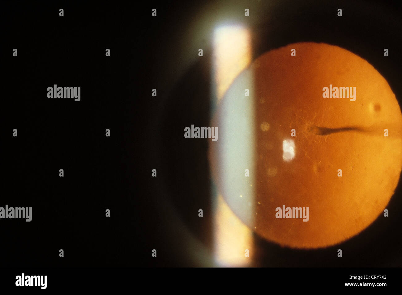 Cristallinus hi-res stock photography and images - Alamy