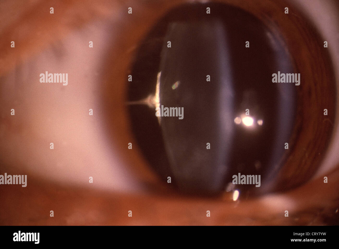 Ophthalmic inflammations hi-res stock photography and images - Alamy