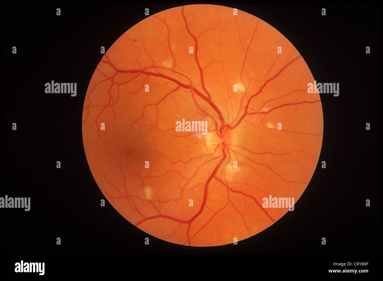 Retinography hi-res stock photography and images - Alamy