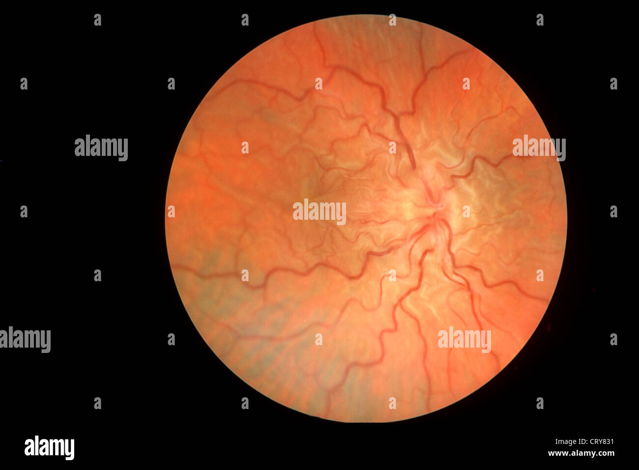 Retinography hi-res stock photography and images - Alamy