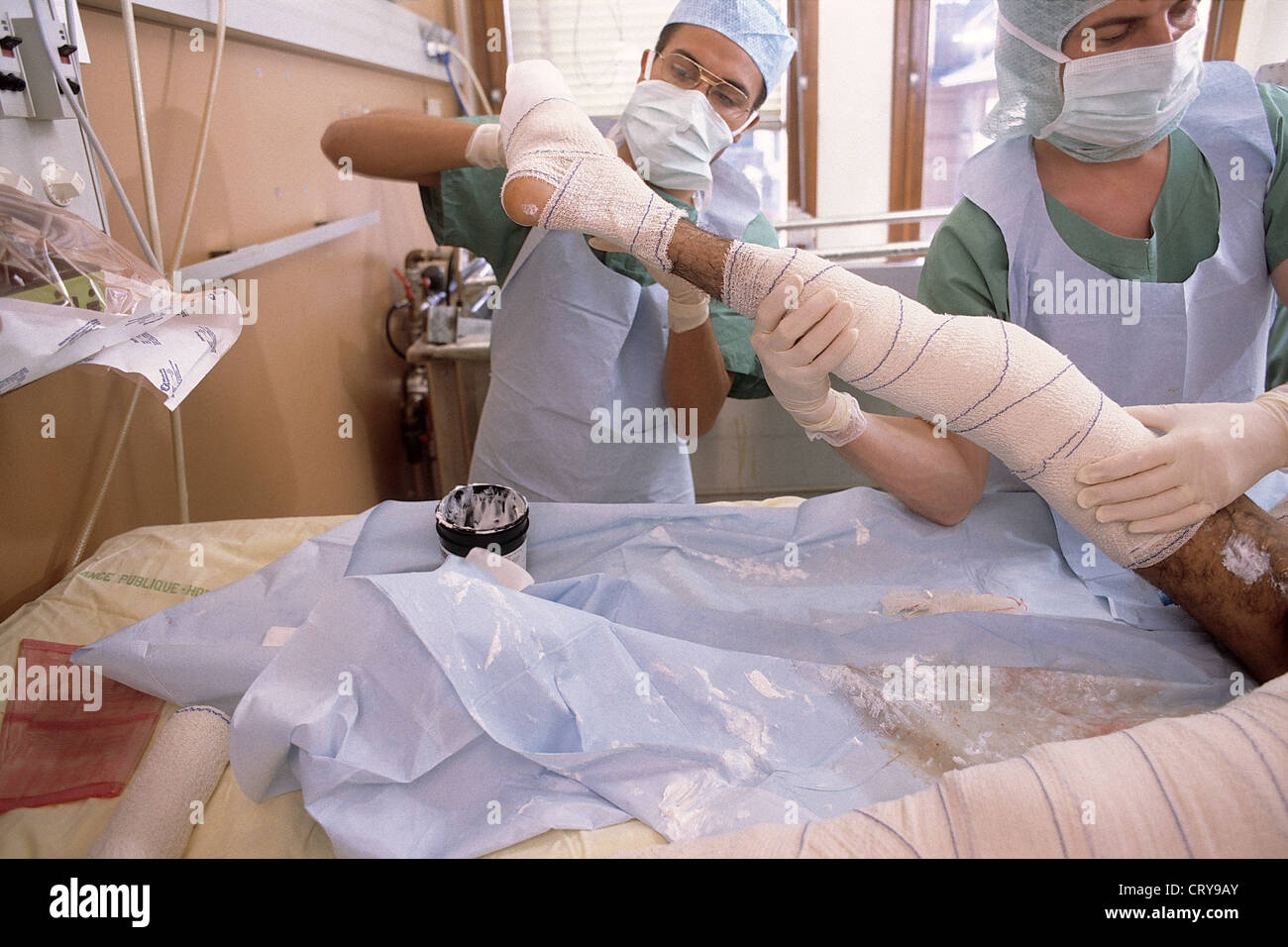 Burn treatment hi-res stock photography and images - Alamy