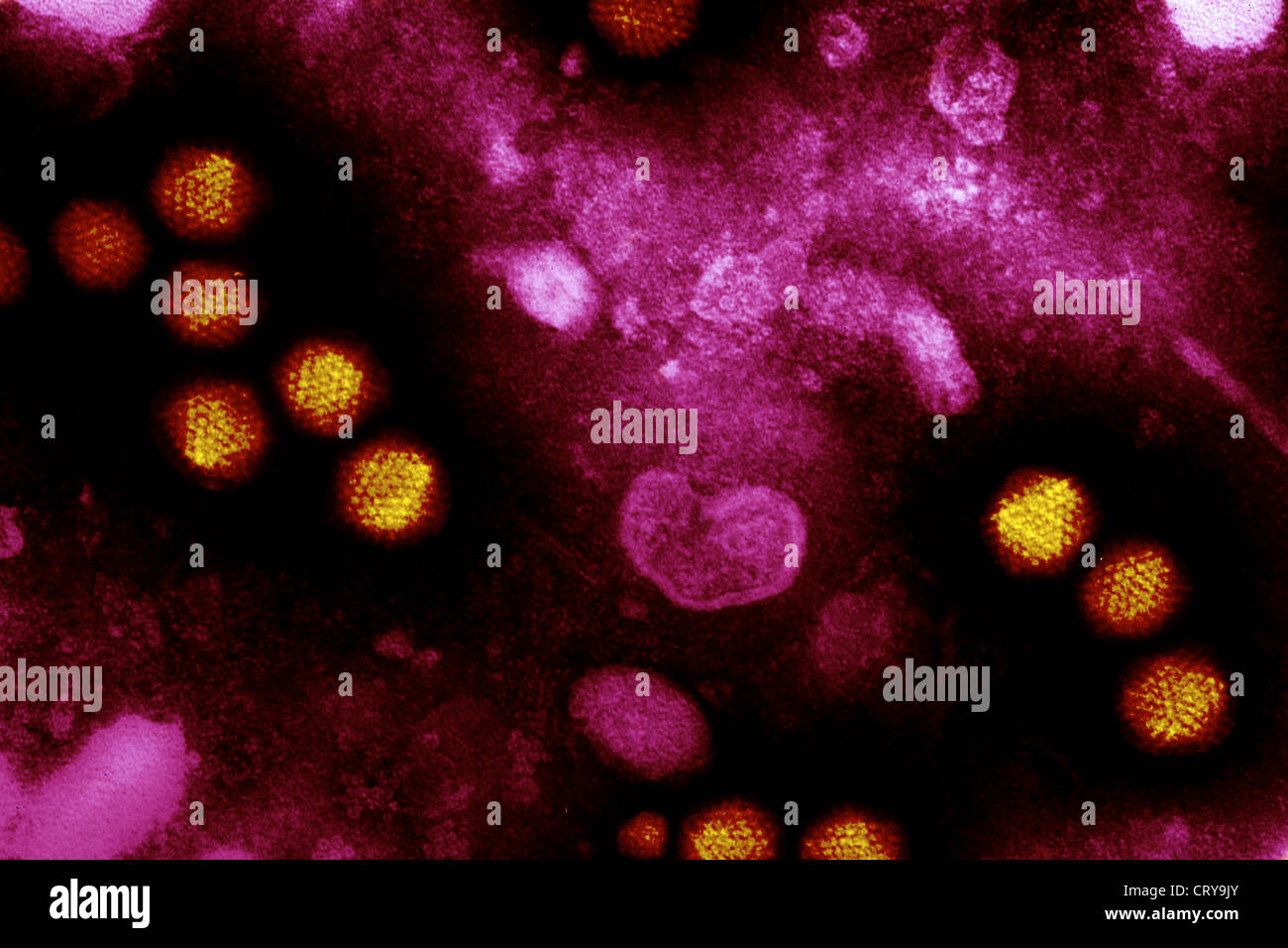 Adenovirus electron hi-res stock photography and images - Alamy