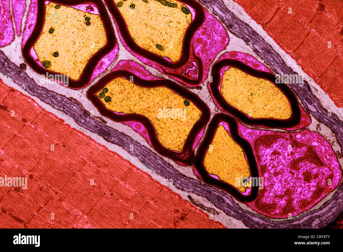 SKELETAL MUSCLE, TEM Stock Photo - Alamy