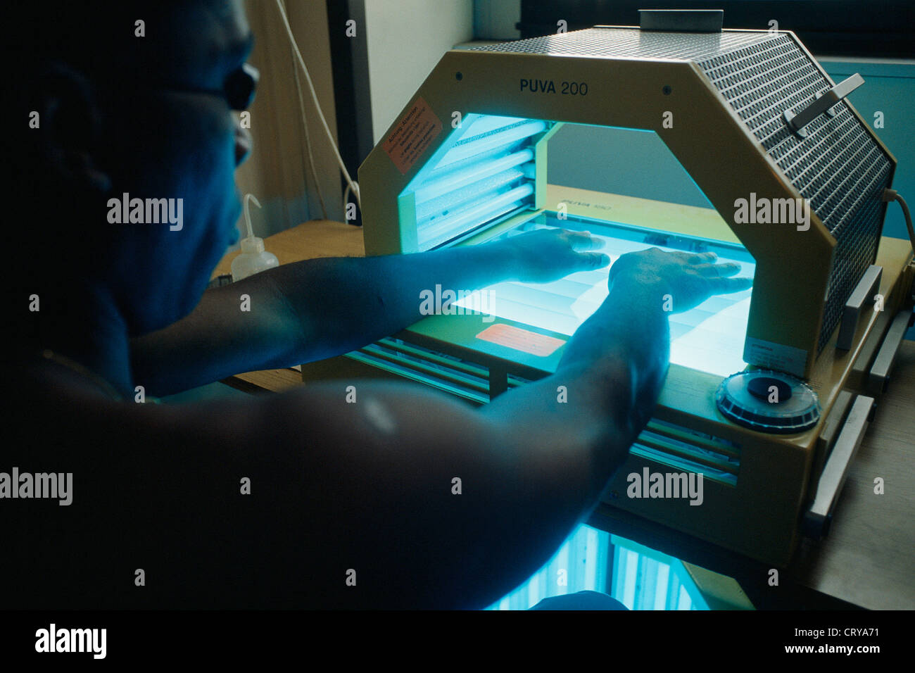 Puva therapy hi-res stock photography and images - Alamy