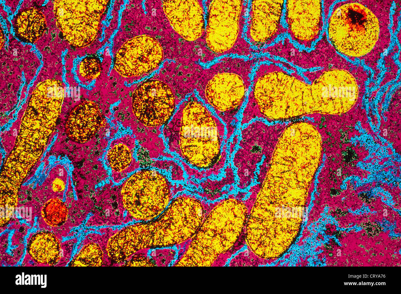 Liver cell electron micrograph hi-res stock photography and images - Alamy