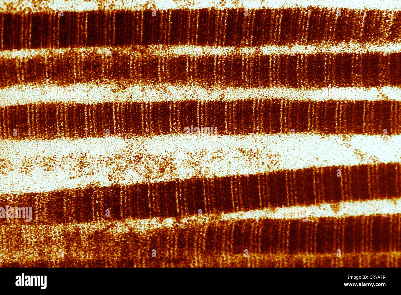 Collagen fiber micrograph hi-res stock photography and images - Alamy