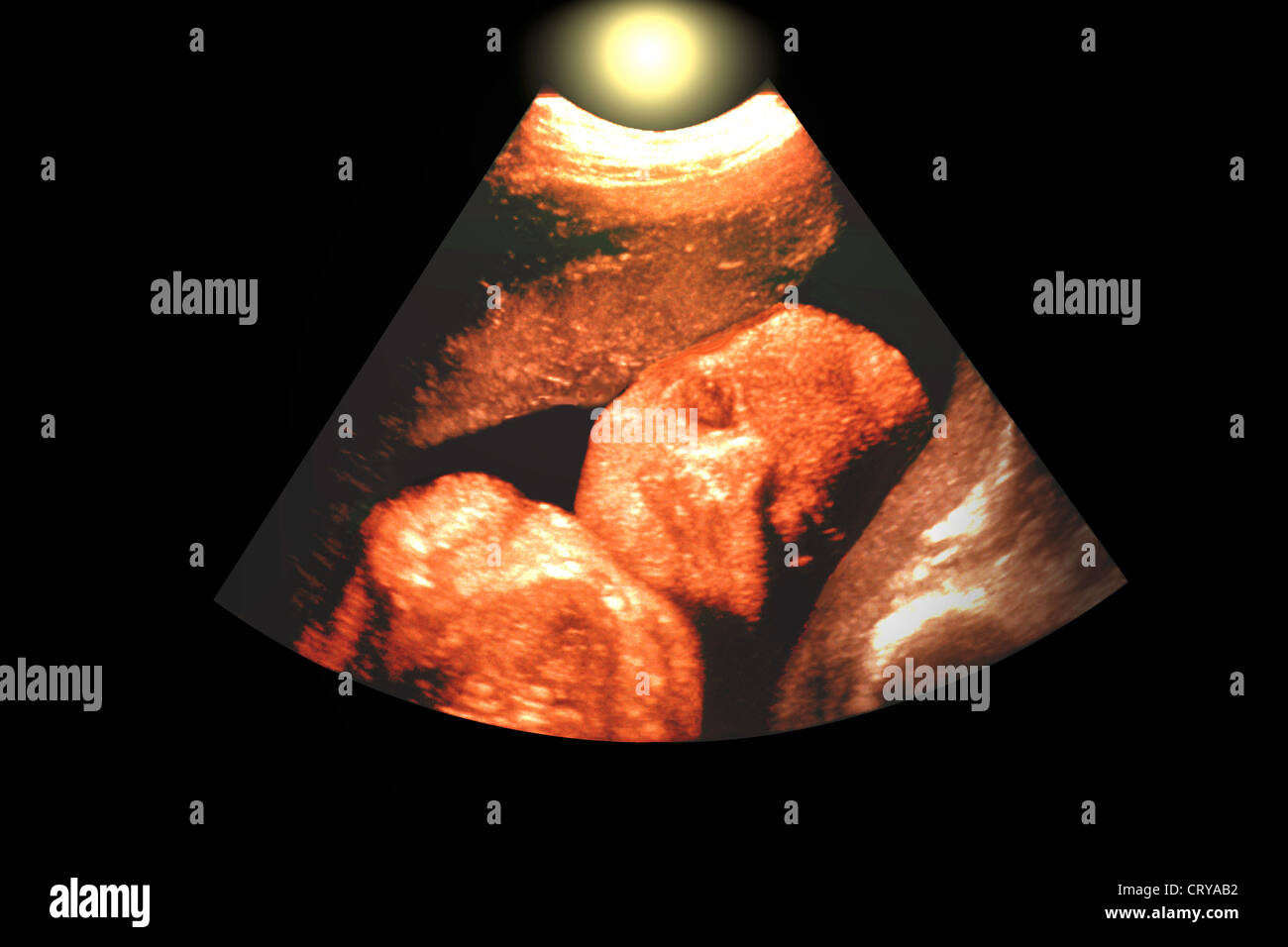 3d imaging fetus hi-res stock photography and images - Alamy