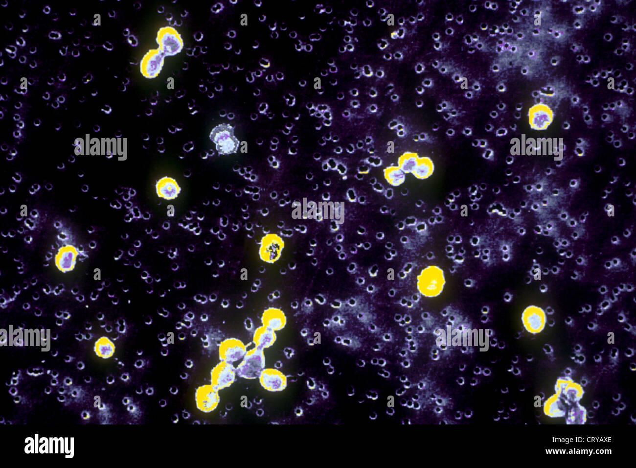 Moraxella branhamella catarrhalis hi-res stock photography and images ...
