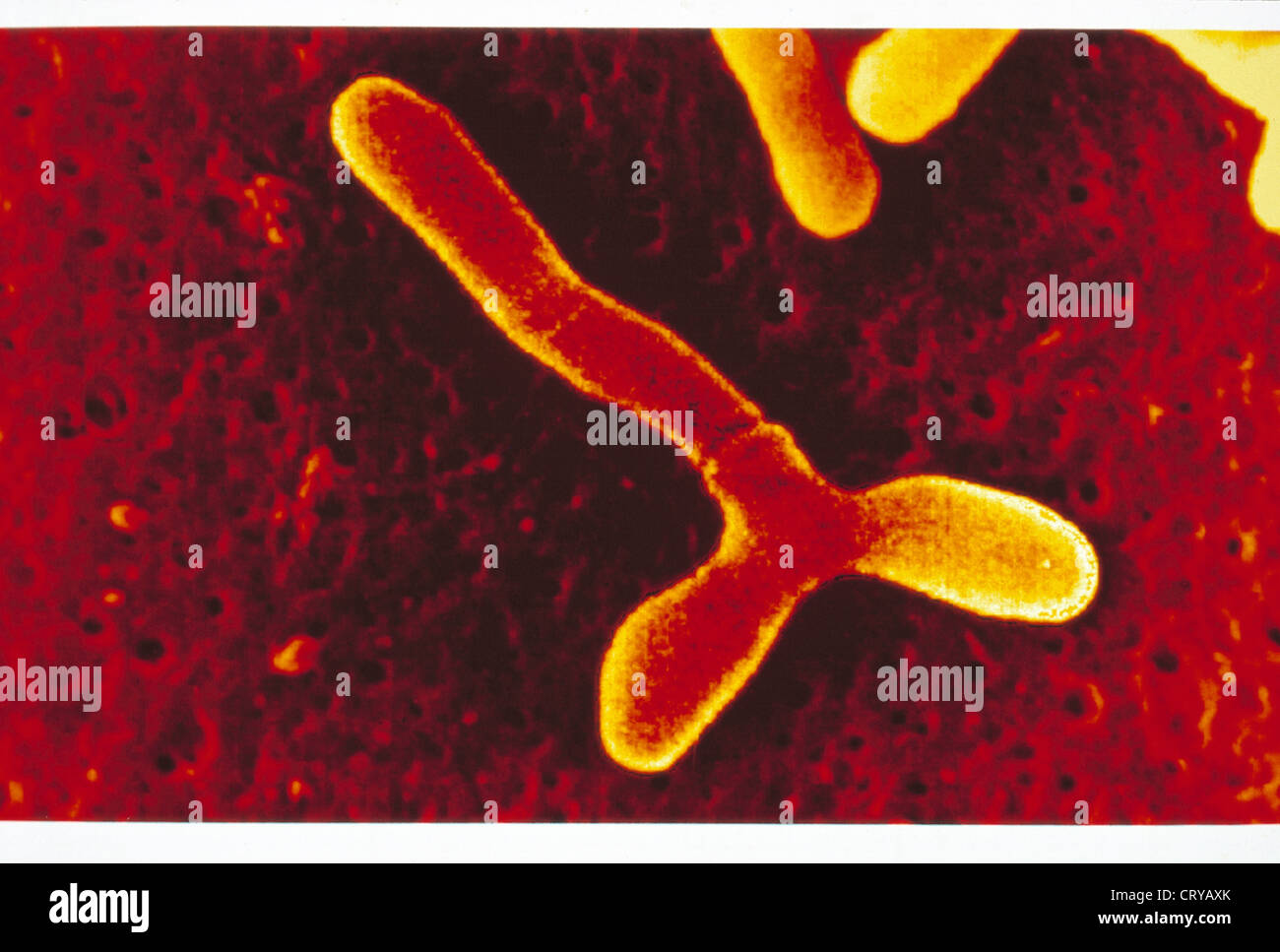 Bifidobacterium bacteria hi-res stock photography and images - Alamy