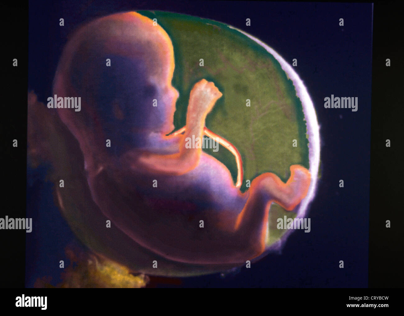 Fetus 5 months hi-res stock photography and images - Alamy