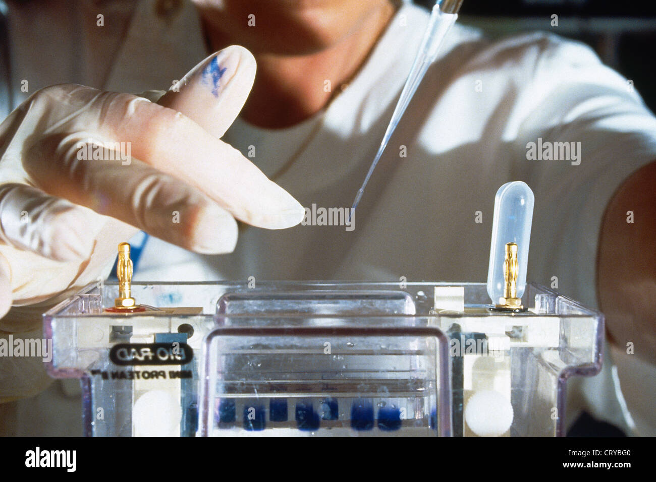 ELECTROPHORESIS OF PLASMA Stock Photo - Alamy