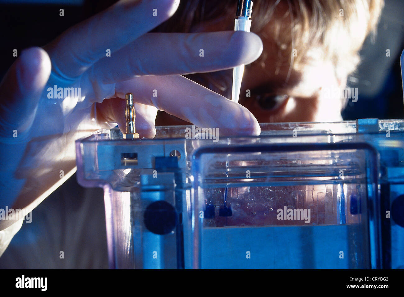 ELECTROPHORESIS OF PLASMA Stock Photo - Alamy