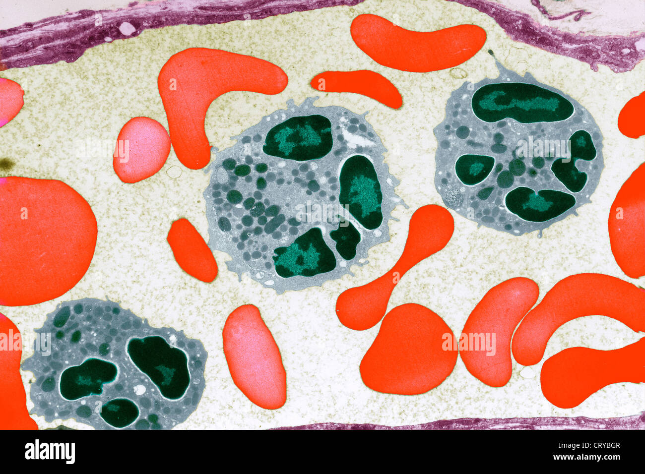 BLOOD CELL, TEM Stock Photo - Alamy