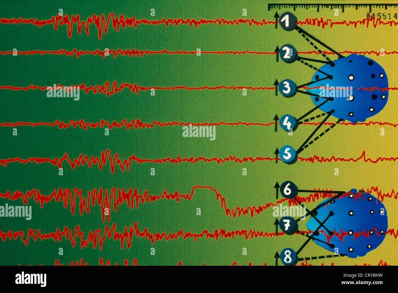 Brain waves eeg hi-res stock photography and images - Alamy Brain waves eeg hi-res stock photography and images - Alamy