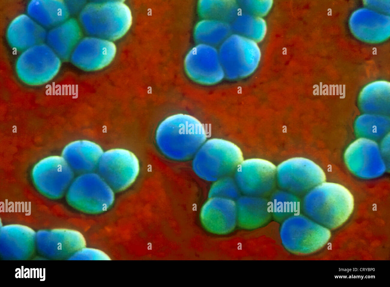 STAPHYLOCOCCUS AUREUS SEM Stock Photo - Alamy