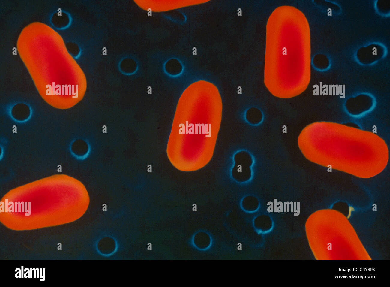 Haemophilus influenzae hi-res stock photography and images - Alamy