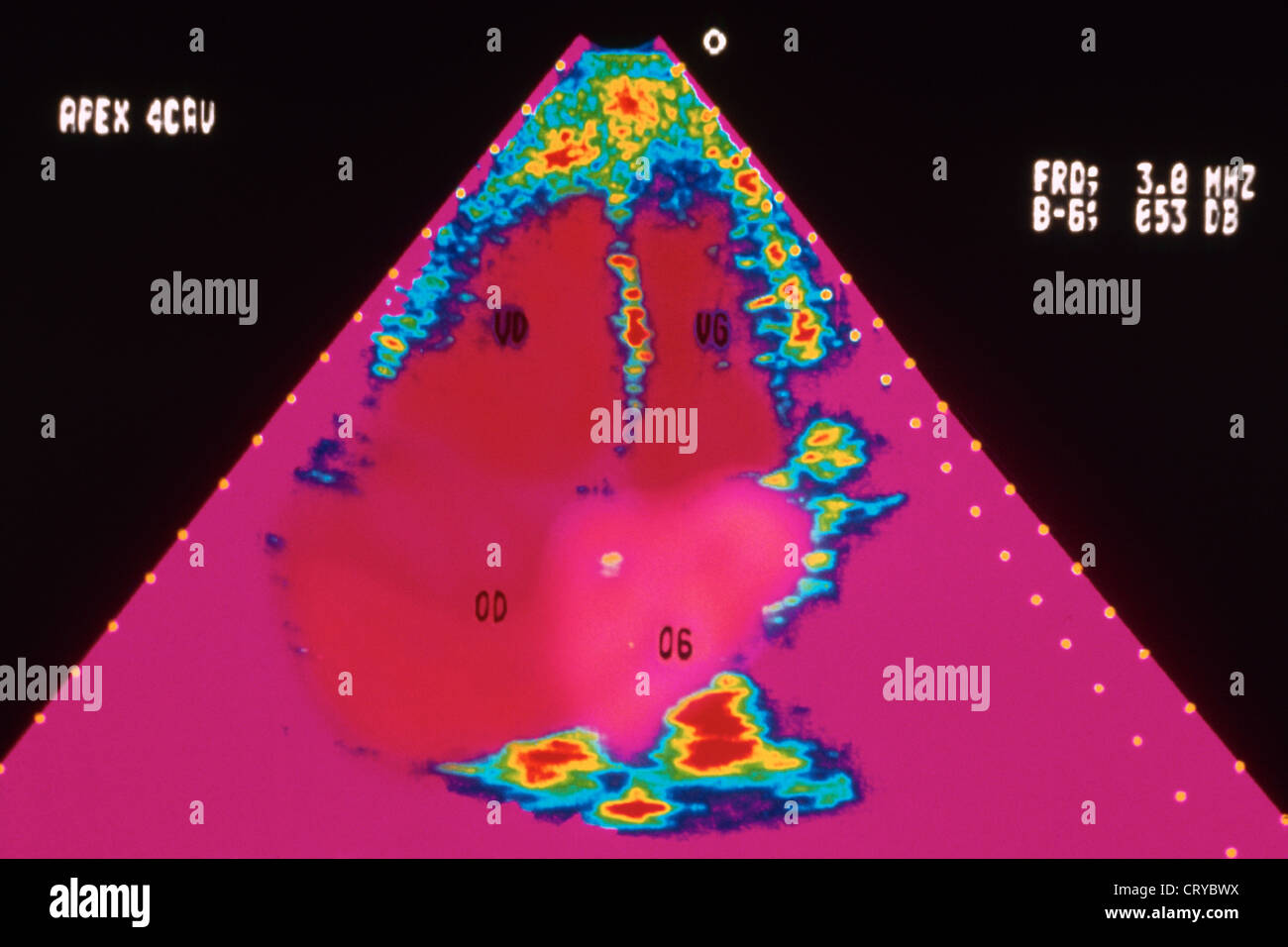 HEART, SONOGRAPHY RESULT Stock Photo - Alamy