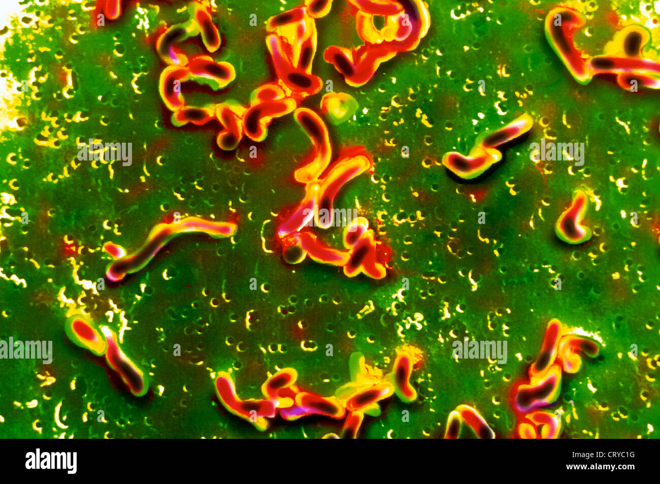 Helicobacter pylori microscope hi-res stock photography and images - Alamy