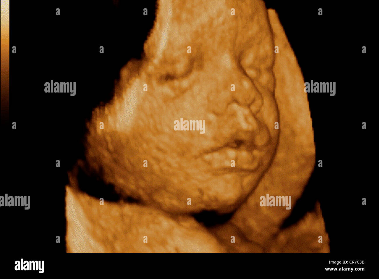 FETUS, 3D SONOGRAPHY Stock Photo - Alamy