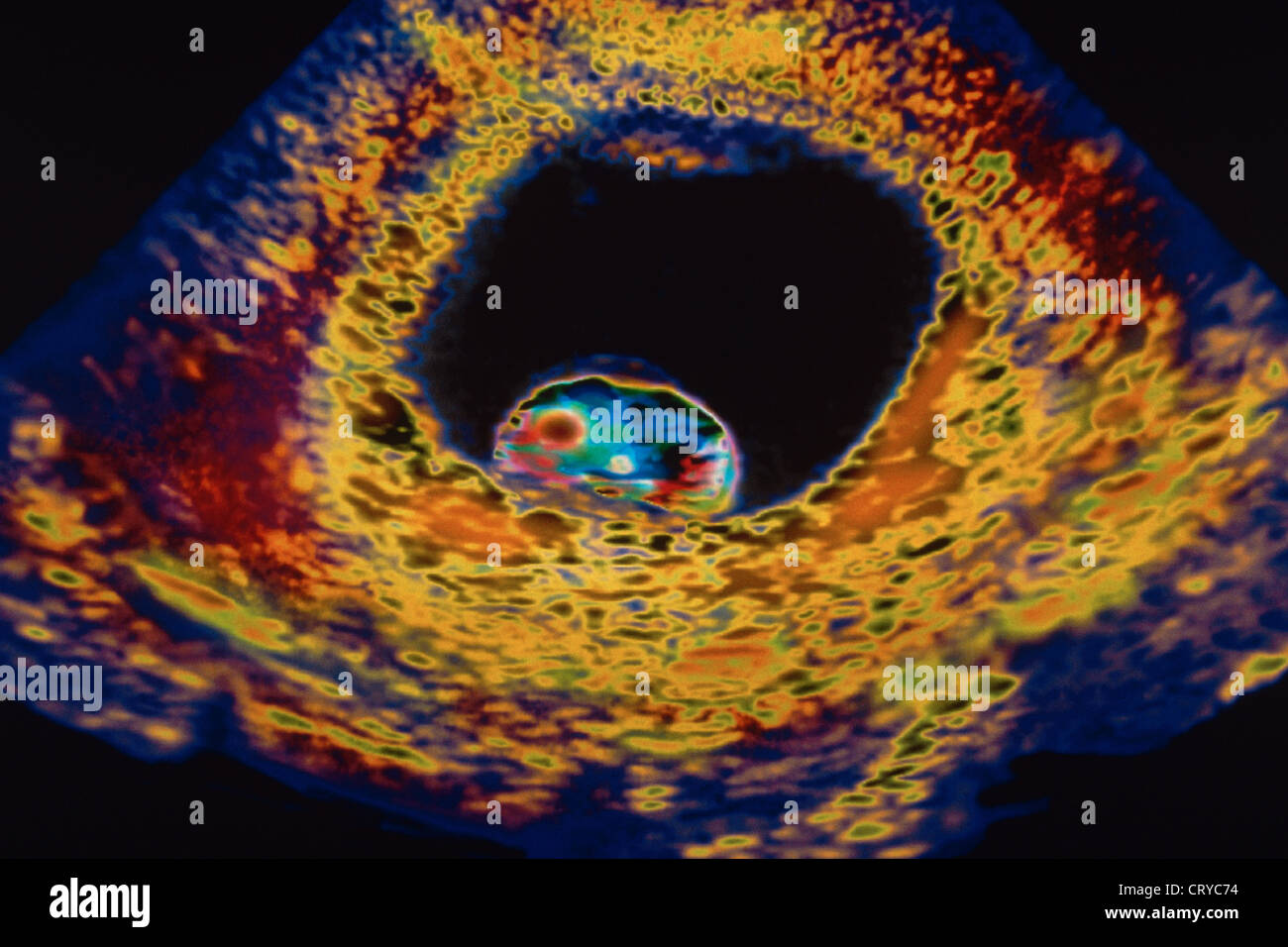 ULTRASOUND BIOMETRY OF THE FETUS Stock Photo - Alamy
