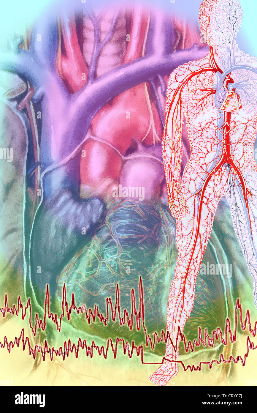 High blood pressure drawing hi-res stock photography and images - Alamy