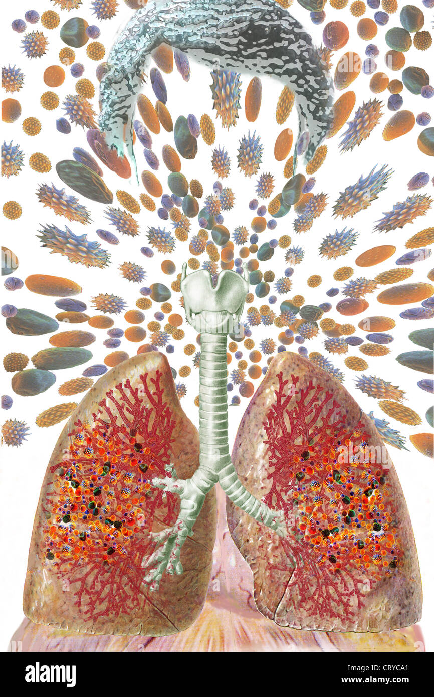 Asthmatic bronchial tubes hi-res stock photography and images - Alamy