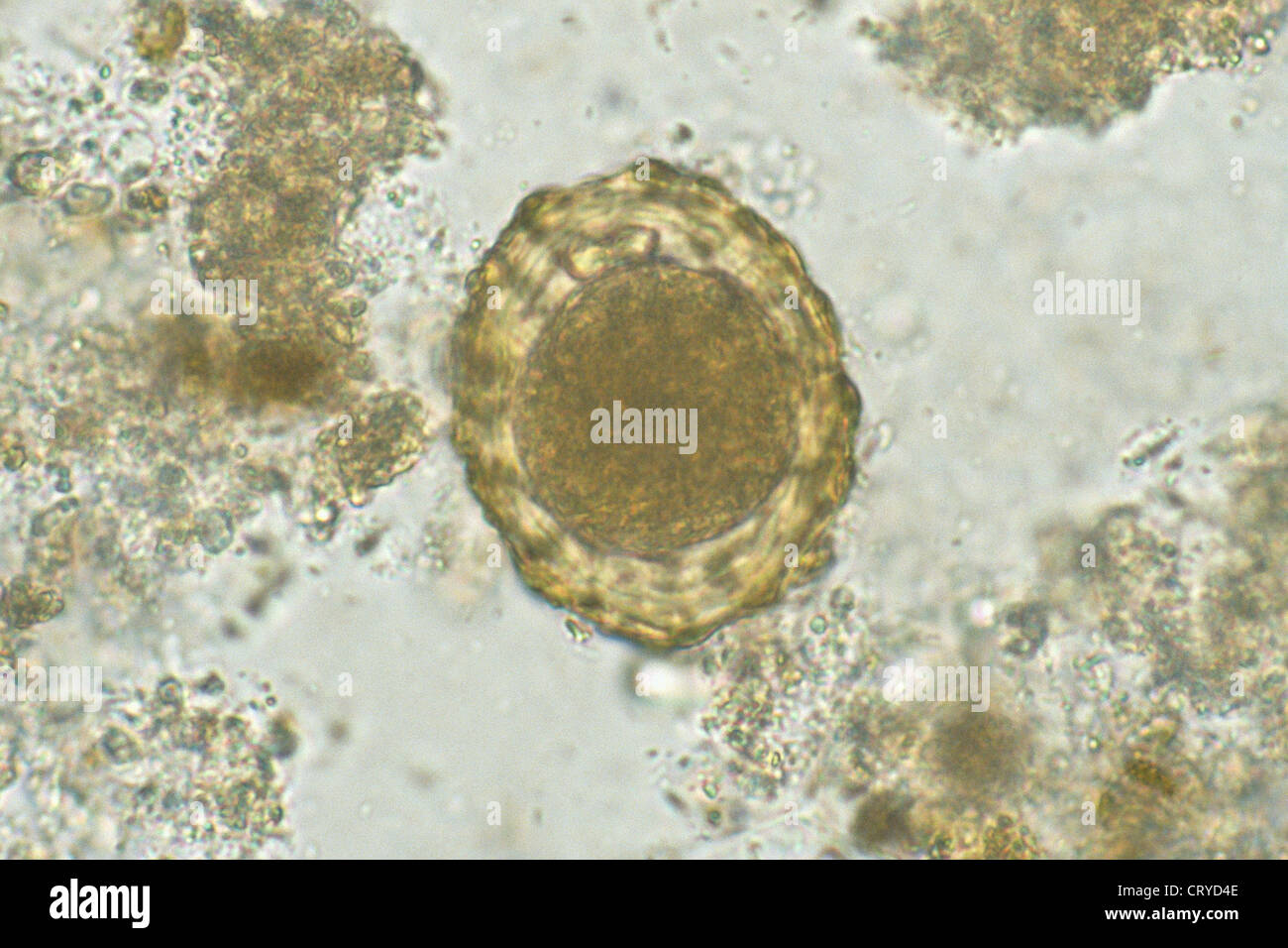 Ascaris worms hi-res stock photography and images - Alamy