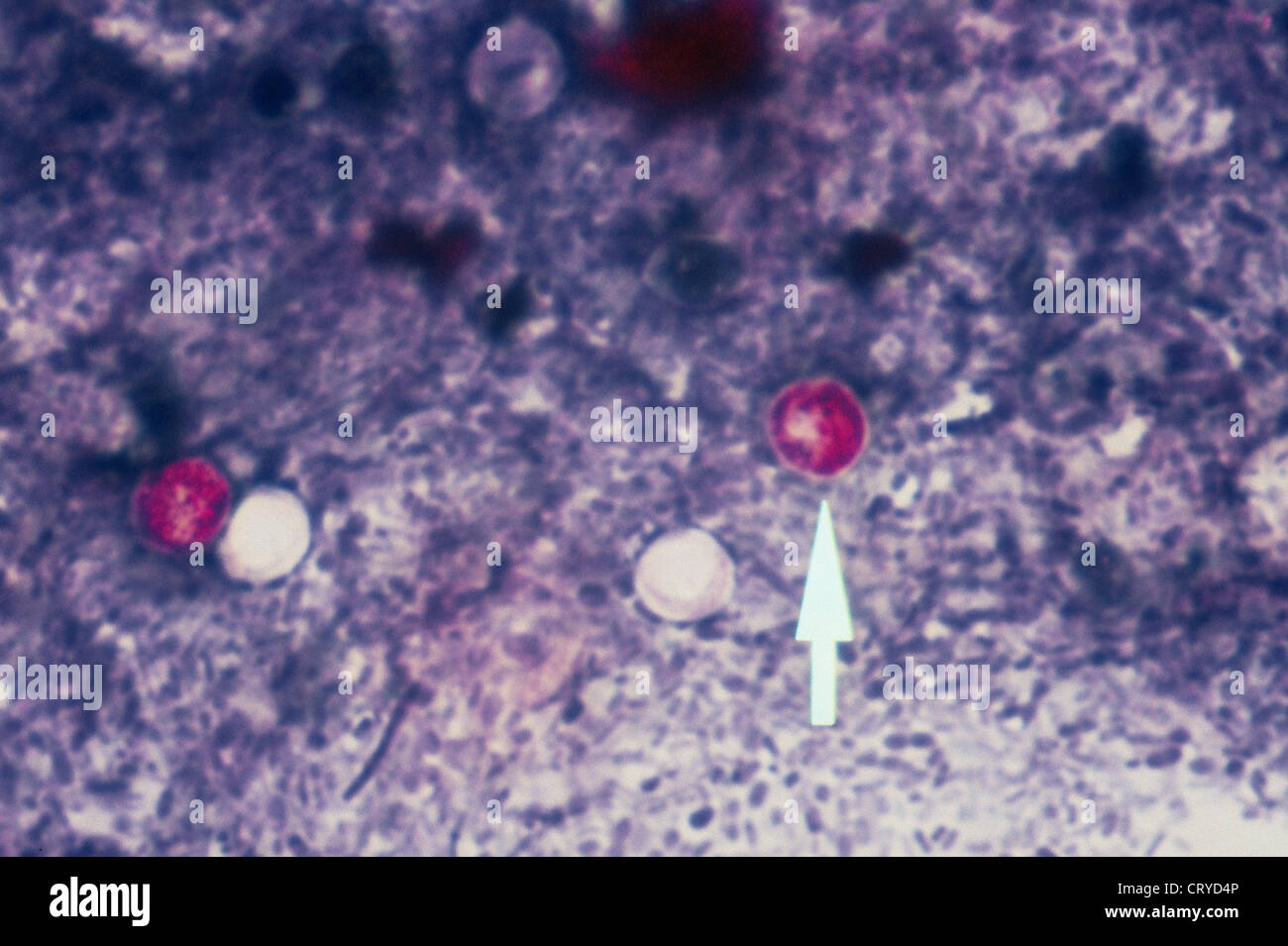 Cryptosporidium hi-res stock photography and images - Alamy