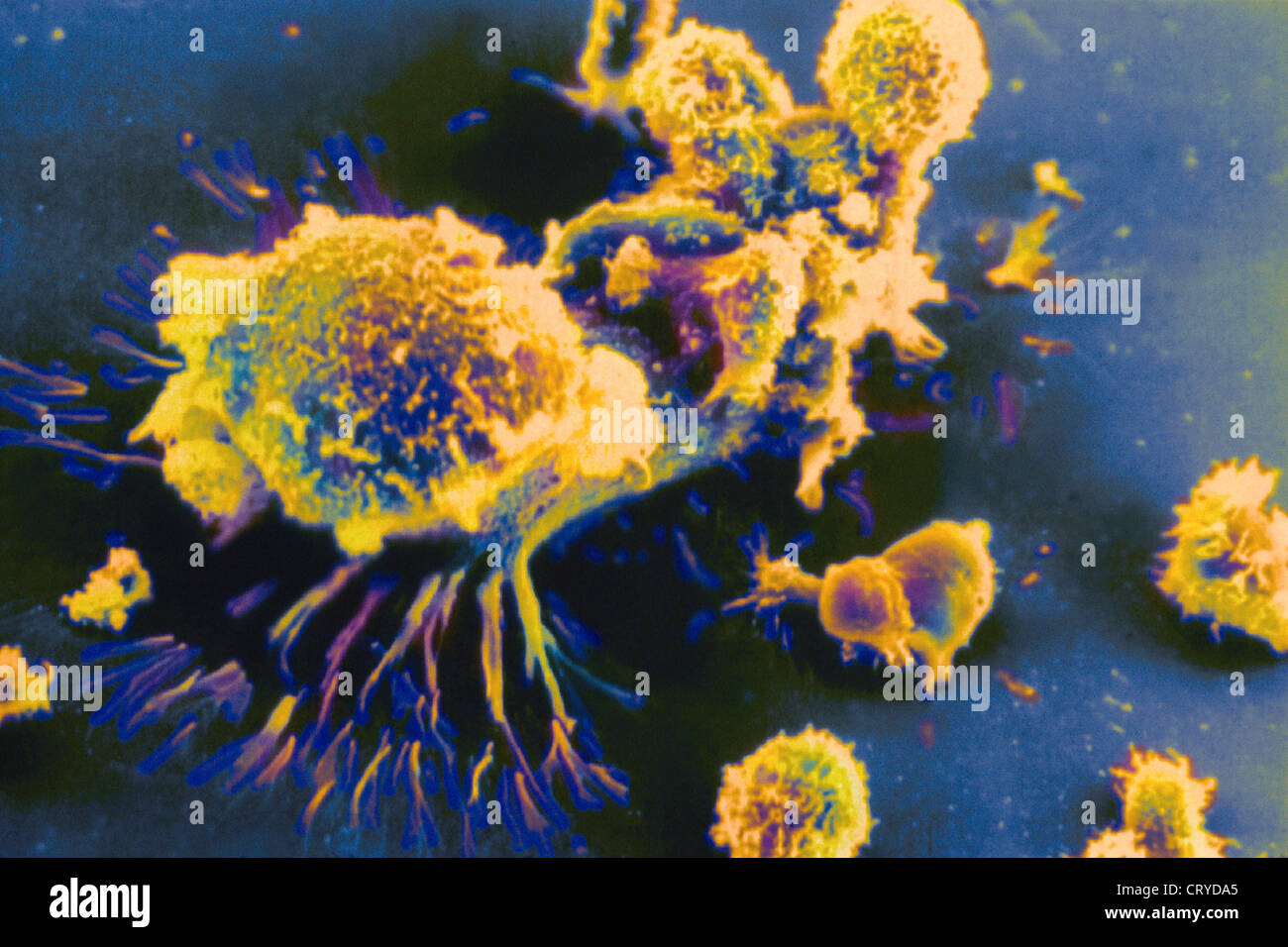 Cancer cells sem hi-res stock photography and images - Alamy