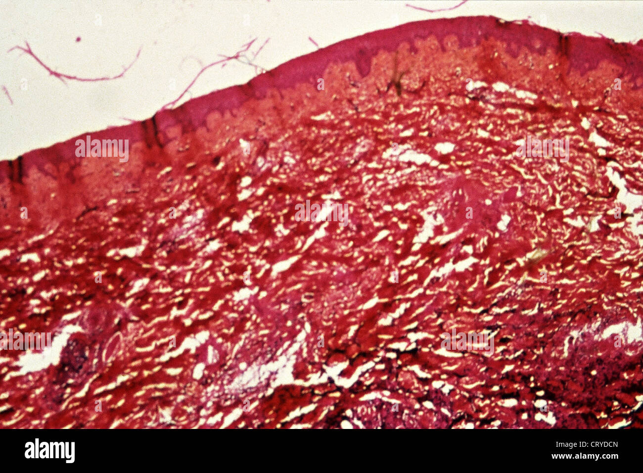 Skin, light micrograph hi-res stock photography and images - Alamy
