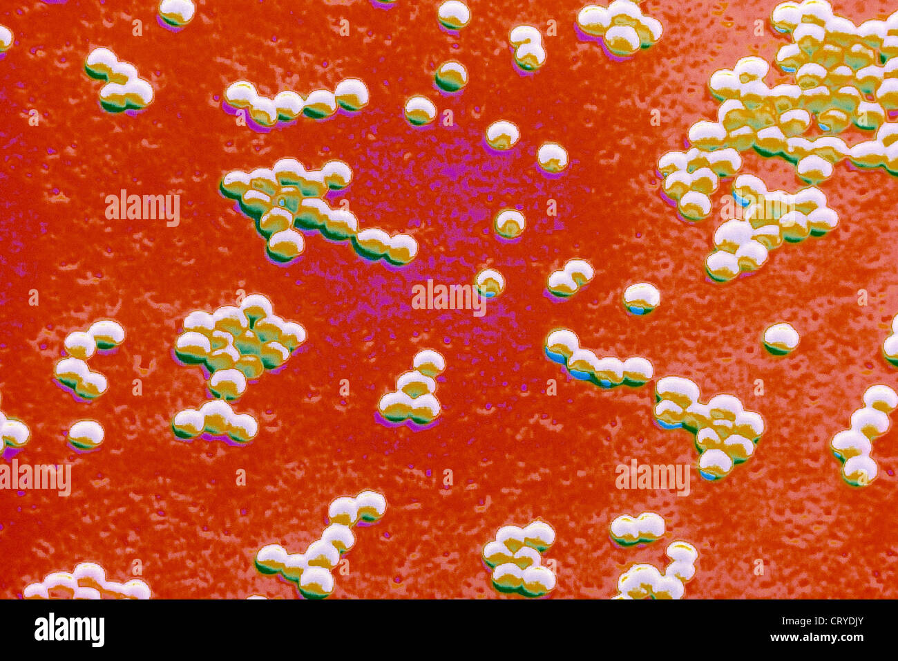STAPHYLOCOCCUS AUREUS SEM Stock Photo - Alamy