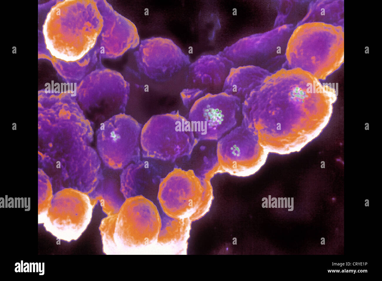 HERPES SIMPLEX VIRUS Stock Photo - Alamy