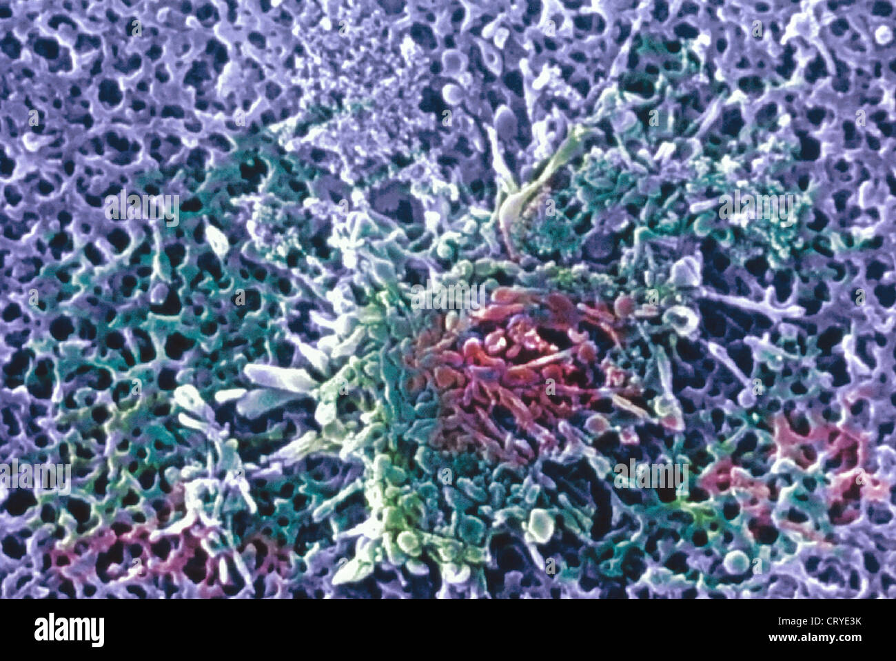 MYCOPLASMA PNEUMONIAE Stock Photo - Alamy