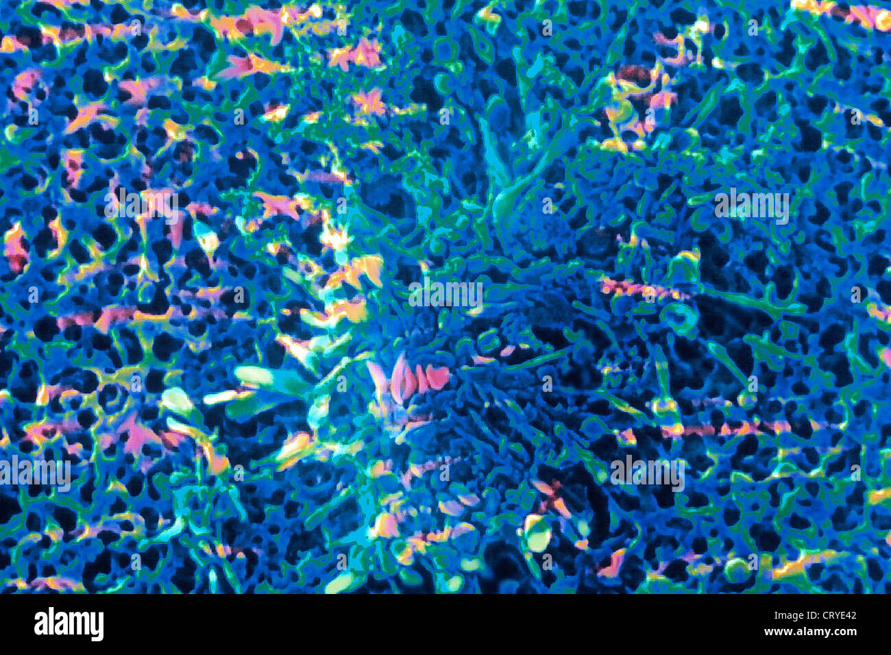 Mycoplasma pneumoniae hi-res stock photography and images - Alamy