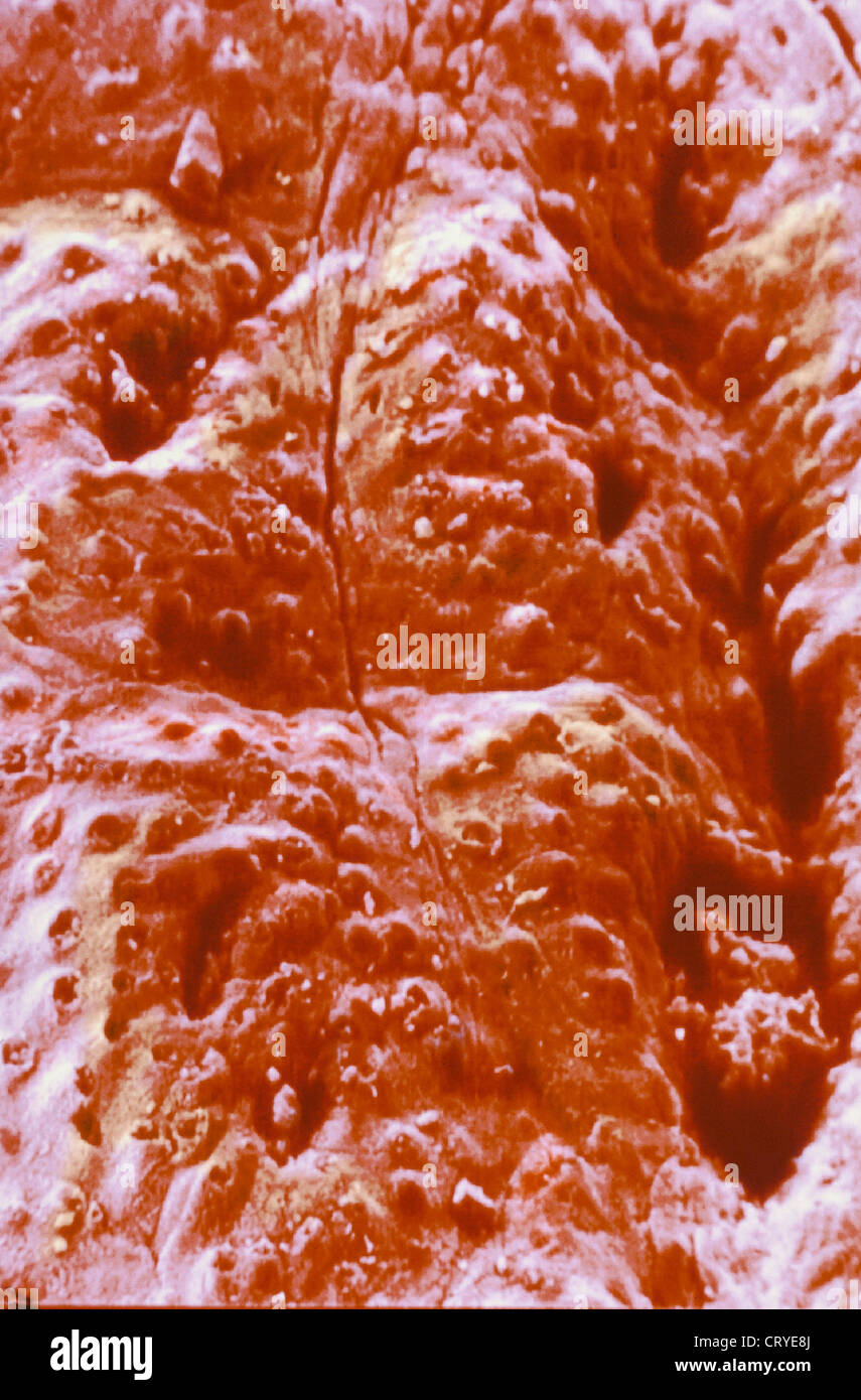 MUCOSA OF THE COLON, SEM Stock Photo - Alamy