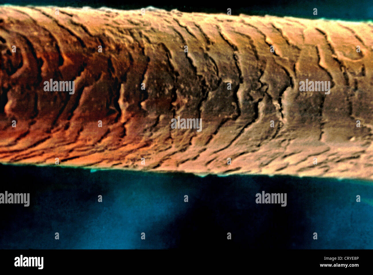 Scanning electron microscope hair hi-res stock photography and images ...