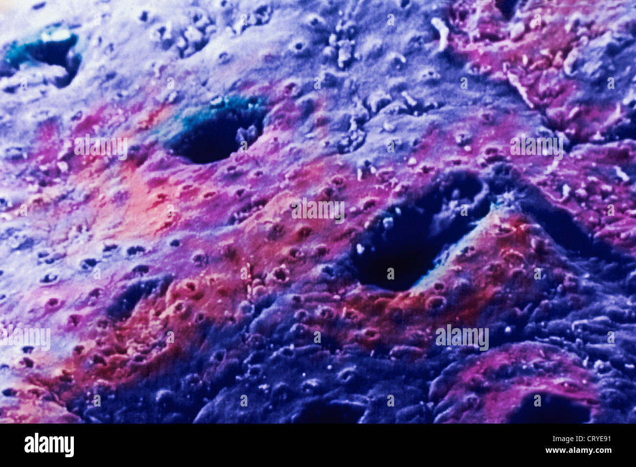 Colonic Glands High Resolution Stock Photography and Images - Alamy